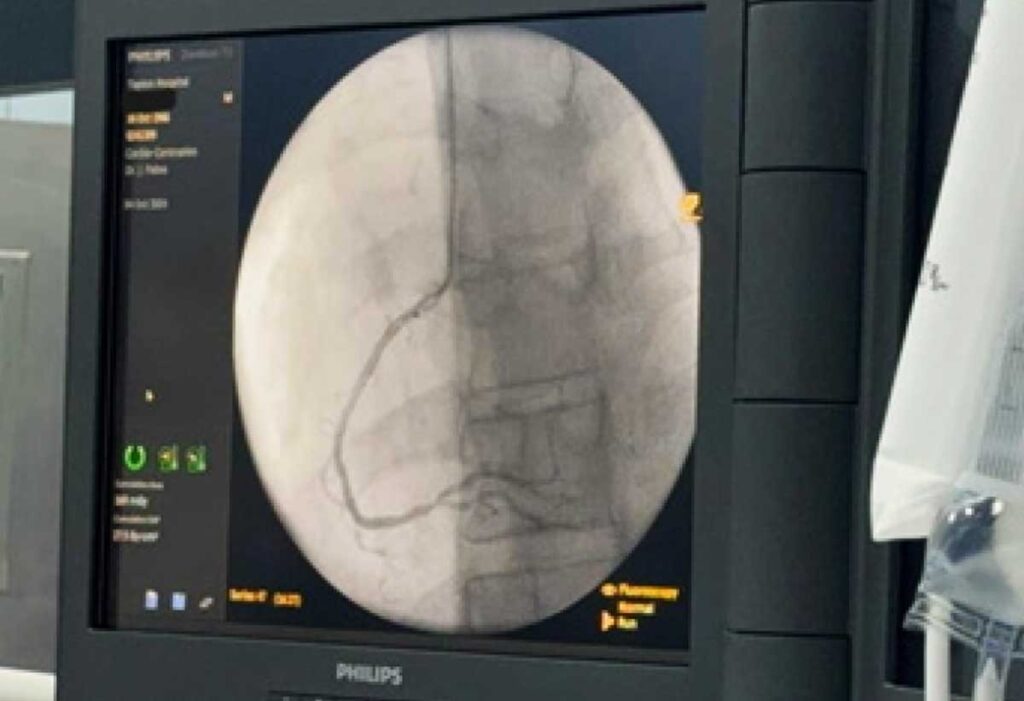 Medical Facility in Saint Lucia Successfully Performs First Coronary ...